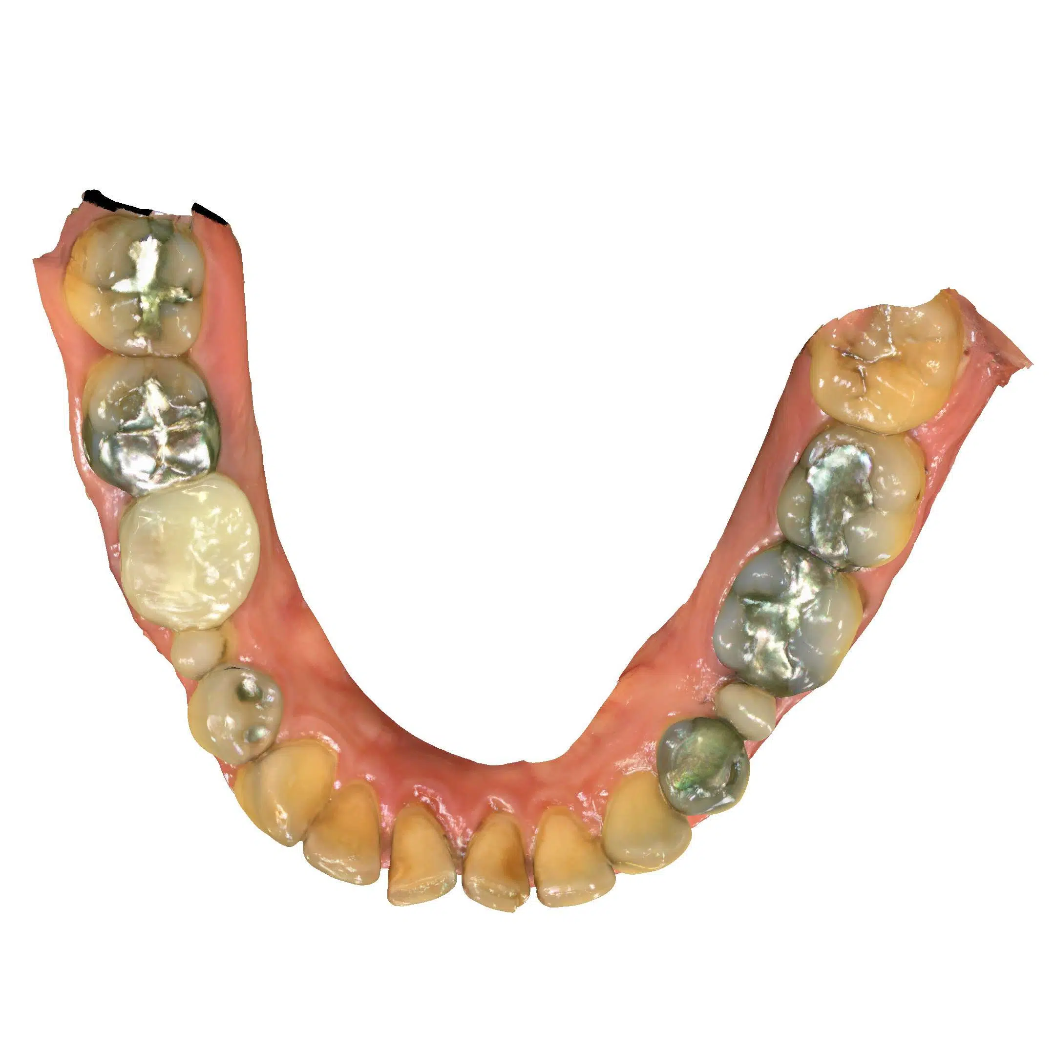 Advanced 3D Dental Scanning - The Aesthetic Smile Collective